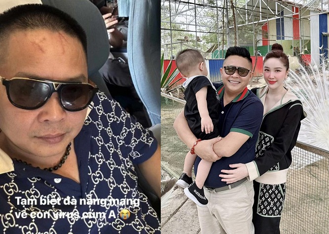 Chồng đại gia Phan Lĩnh của ca sĩ Bảo Thy hiếm hoi đăng ảnh selfie, trán đầy sẹo gây chú ý